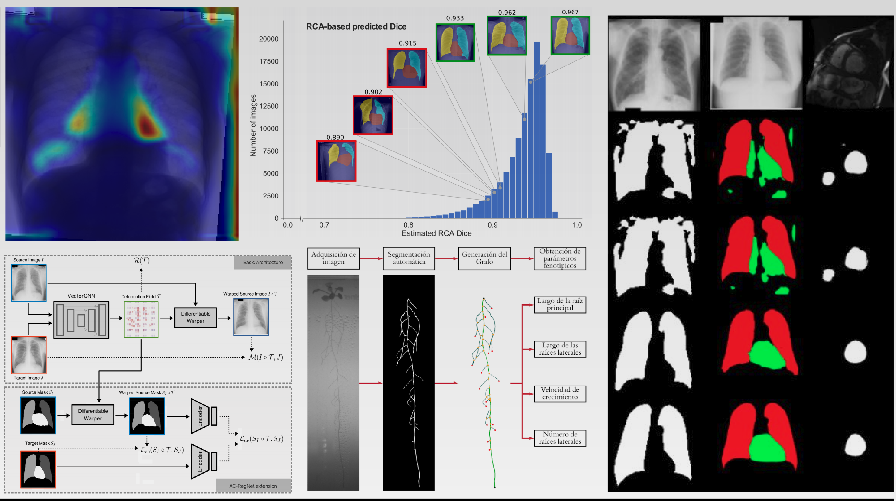 Deep Learning para la segmentación de imágenes médicas – Departamento ...
